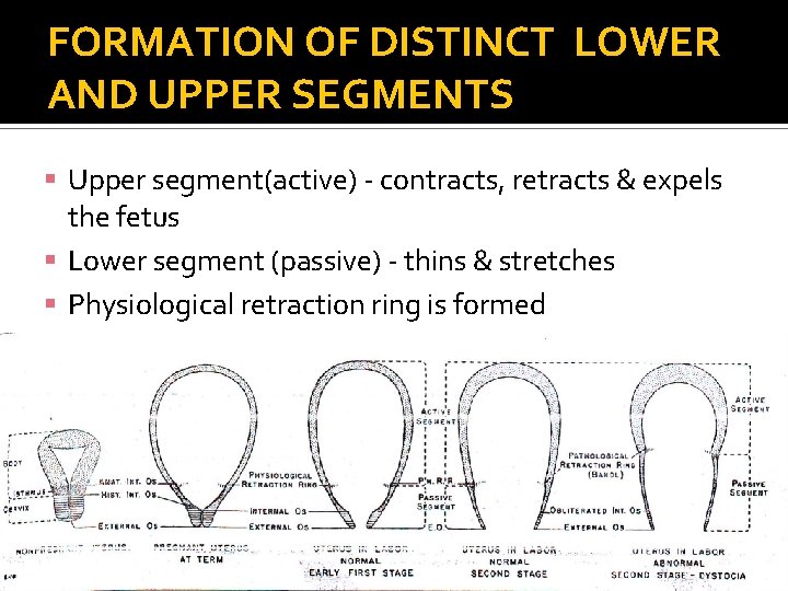 PHYSIOLOGY OF NORMAL LABOUR DEFINITION Series of events