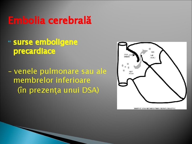 FIZIOPATOLOGIA SISTEMULUI NERVOS A FIZIOPATOLOGIA TULBURRILOR DE CIRCULAIE