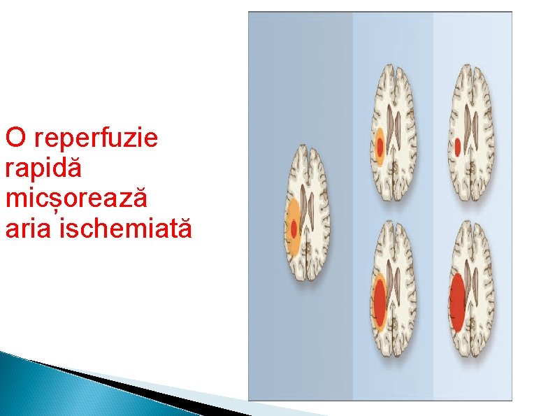 FIZIOPATOLOGIA SISTEMULUI NERVOS A FIZIOPATOLOGIA TULBURRILOR DE CIRCULAIE