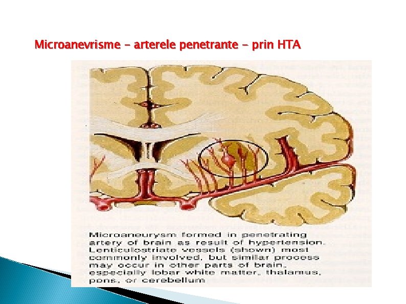 FIZIOPATOLOGIA SISTEMULUI NERVOS A FIZIOPATOLOGIA TULBURRILOR DE CIRCULAIE