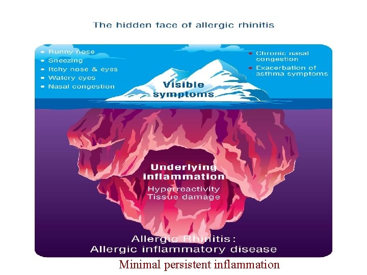ARIA guideline 2001 Allergic Rhinitis and its Impact