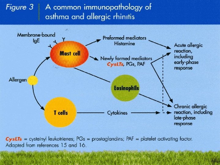 ARIA guideline 2001 Allergic Rhinitis and its Impact
