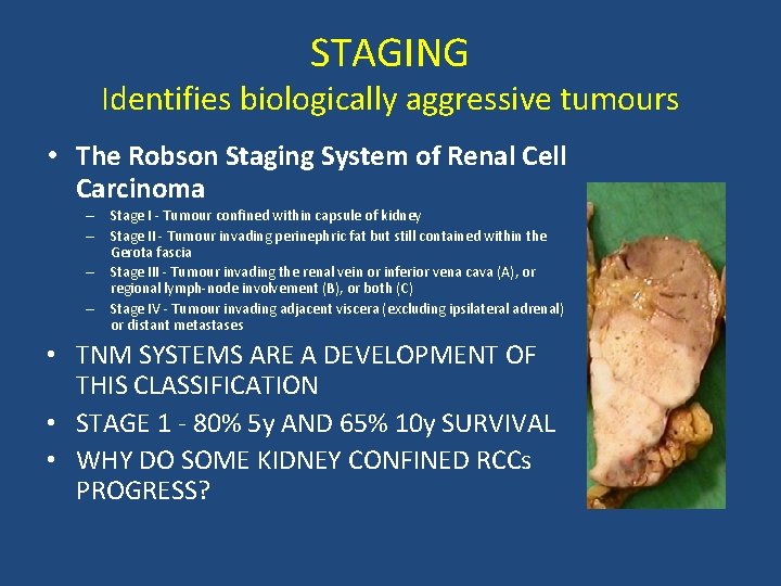 NEW APPROACHES IN CANCER PATHOLOGY LESSONS FROM RENAL