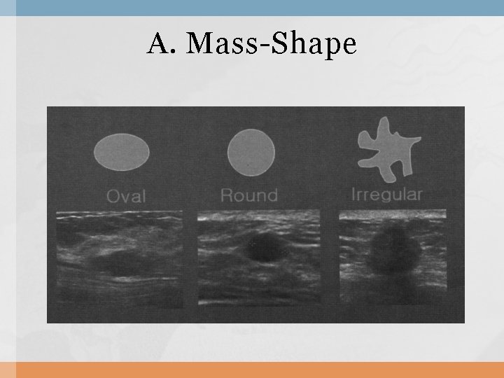 BI RADS breast imaging reporting and data system