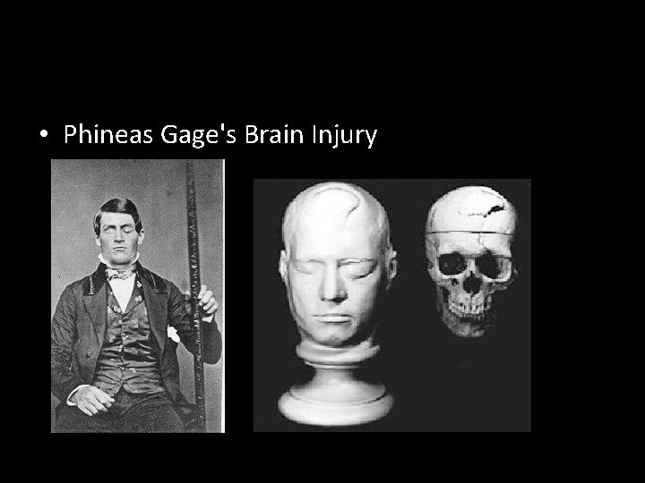 The Brain Anatomy Function HSP 3 U Psychology