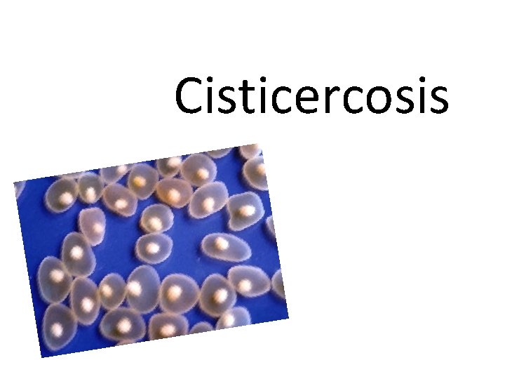 Cisticercosis Concepto La cisticercosis es una parasitosis de
