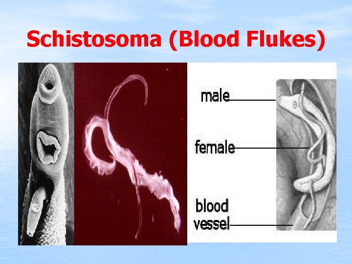 TREMATODES 1 Schistosoma Blood Flukes Do Dr Hrisi