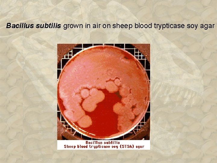 Gram positive bacilli Bacillus spp Corynebacterium diphteria ...