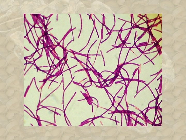 Gram positive bacilli Bacillus spp Corynebacterium diphteria ...