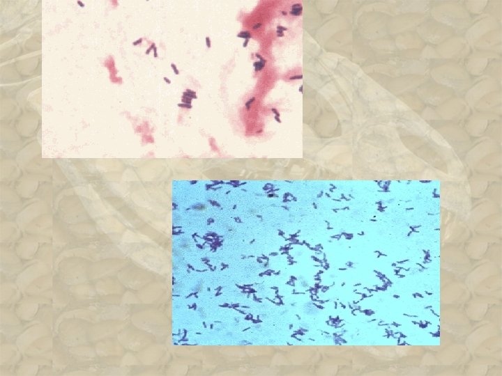 Gram positive bacilli Bacillus spp Corynebacterium diphteria ...