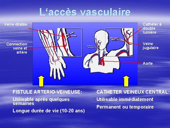 HEMODIALYSE Dr R Milongo AGDUC CHU de Grenoble