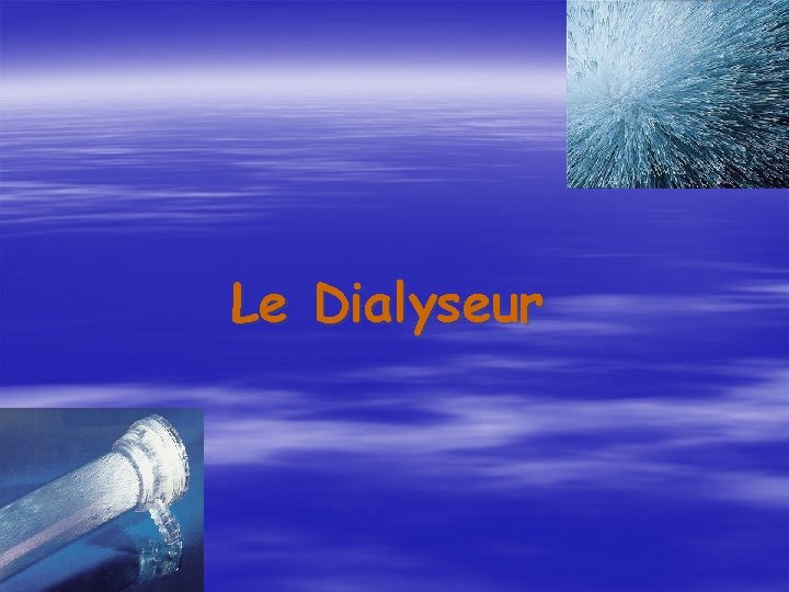 HEMODIALYSE Dr R Milongo AGDUC CHU de Grenoble