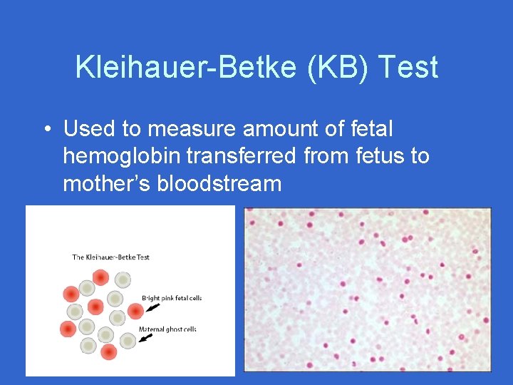 Is the administration of Rho Gam indicated among