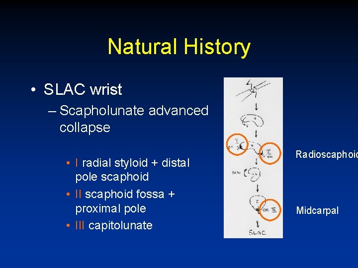 SLAC SNAC wrists Management Results Satyam Patel January