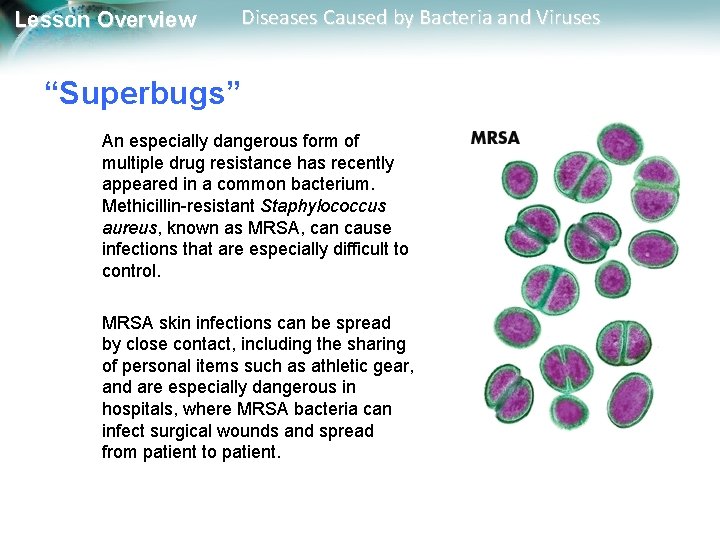 Lesson Overview Diseases Caused by Bacteria and Viruses