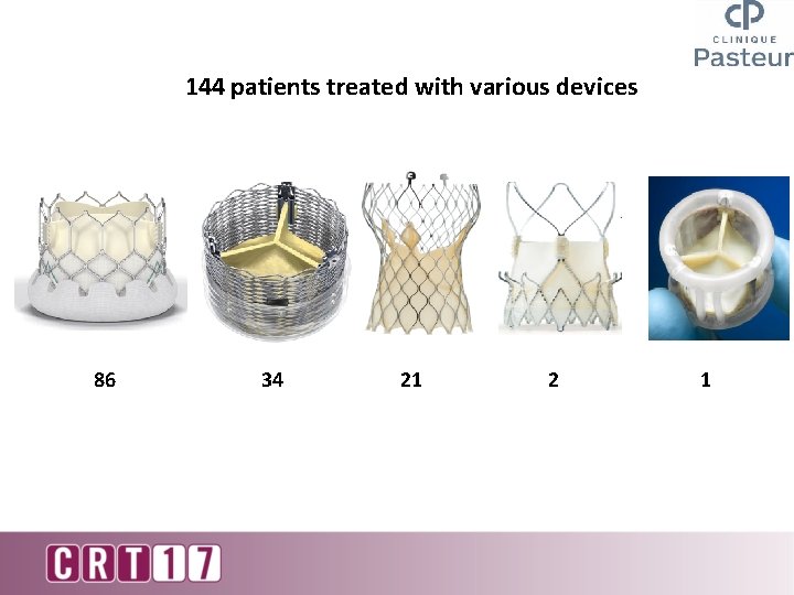 Second Generation TAVR devices for Bicuspid Disease Outcomes