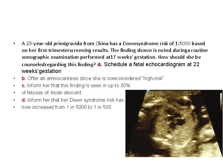 Prenatal dx A 36 yearold primigravida at 20