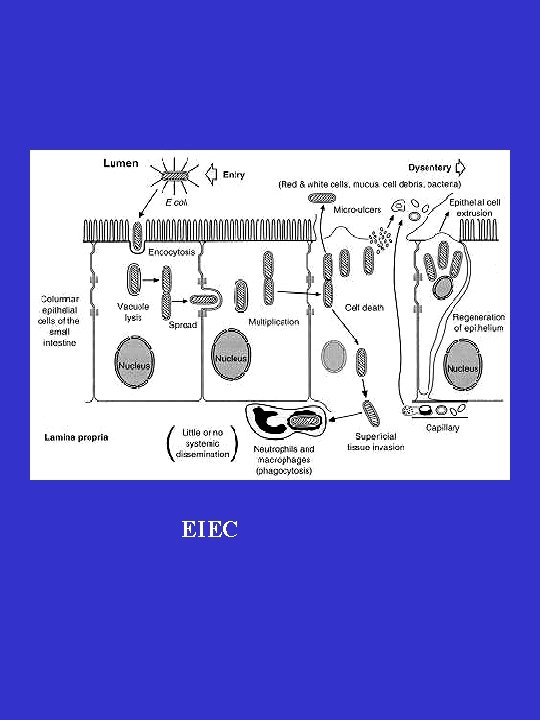 ESCHERICHIA COLI Enterobacteriaceae csald Escherichia genus norml vastagbl