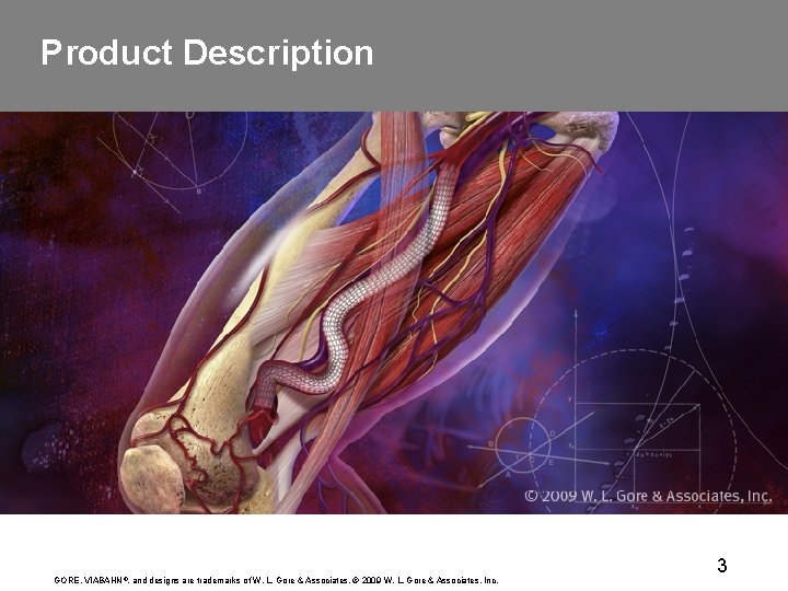 GORE VIABAHN Endoprosthesis Speakers Presentation Resource GORE VIABAHN