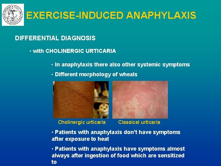 Exerciseinduced anaphylaxis Dr Enrico Heffler enricoheffleryahoo it MD