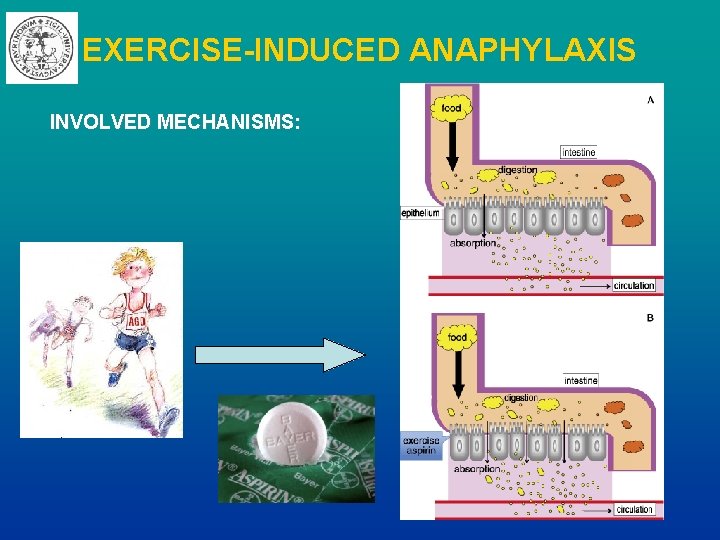 Exerciseinduced anaphylaxis Dr Enrico Heffler enricoheffleryahoo it MD