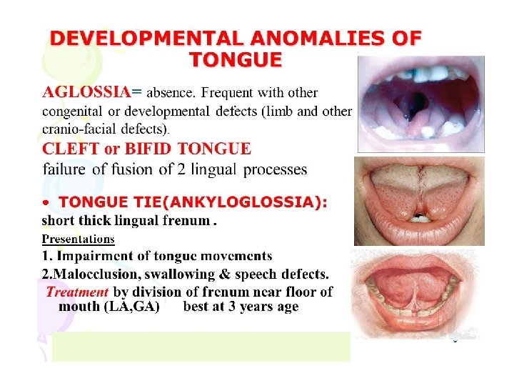 Embryology of Teeth Tongue Thyroid Dr Shivaram Bhat
