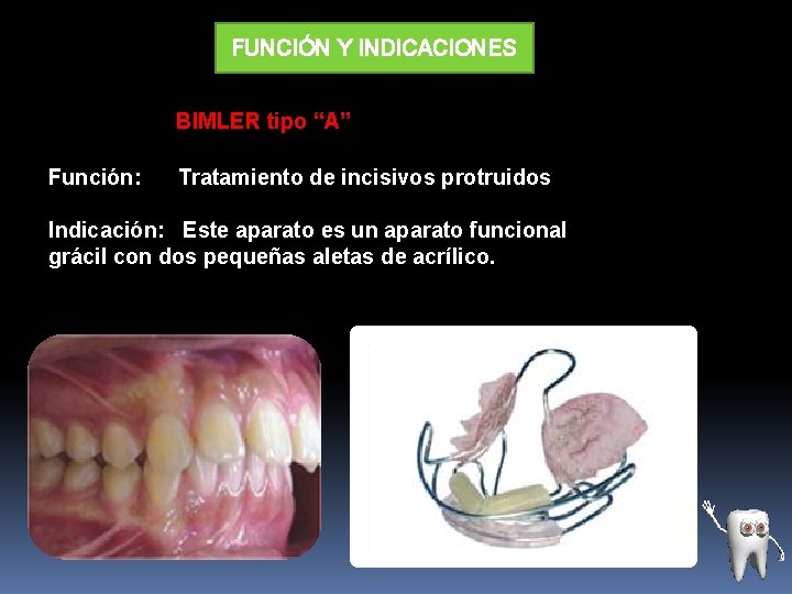 Modelador Elstico de Bimler Para la Clase I