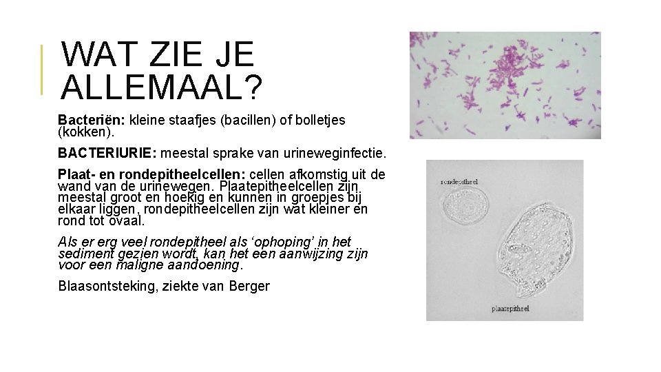 LABORATORIUMWERK Urinesediment wat zit er allemaal in en