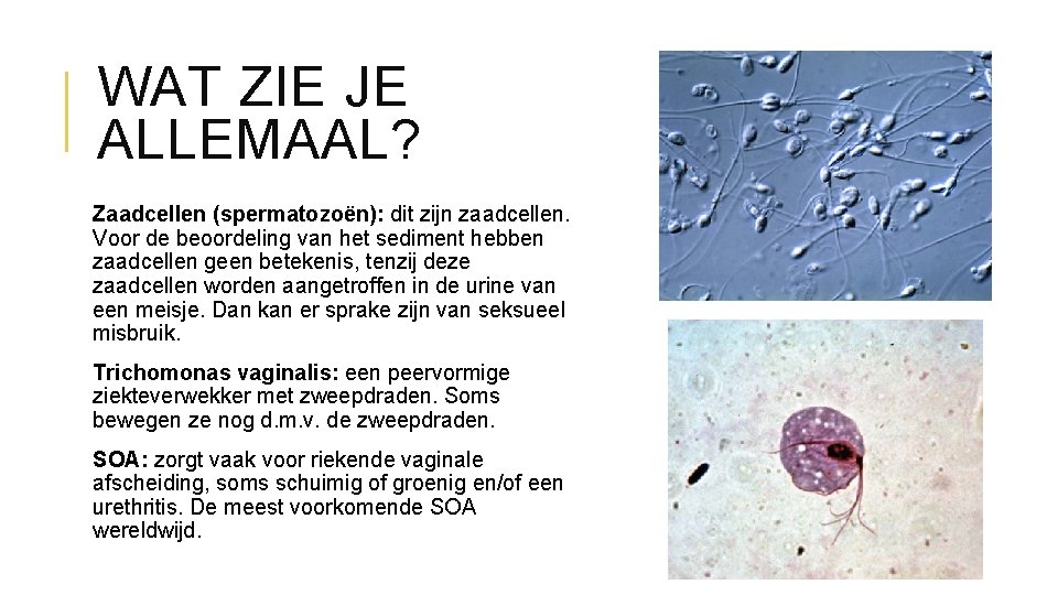 LABORATORIUMWERK Urinesediment wat zit er allemaal in en