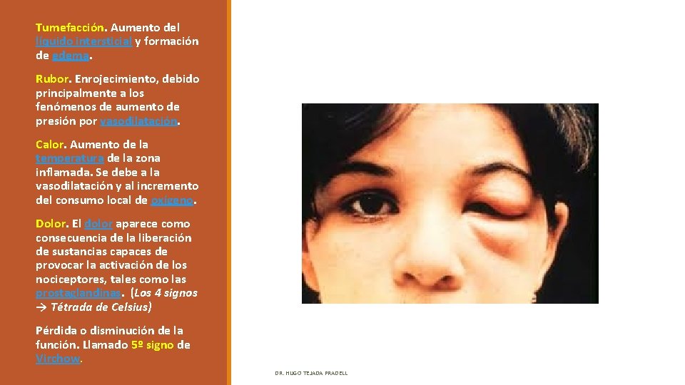 INFLAMACIN REGENERACIN CICATRIZACIN INMUNIDAD Y ALERGIA FUNDAMENTOS ...