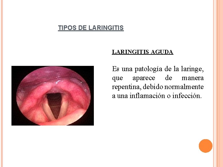 UNIDAD 5 ANATOMIA LARINGEA ANATOMA LARINGEA La Laringe