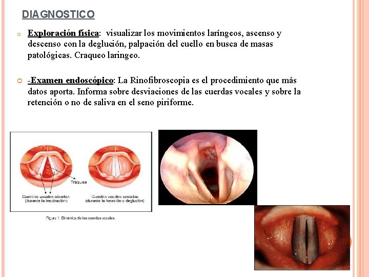 UNIDAD 5 ANATOMIA LARINGEA ANATOMA LARINGEA La Laringe