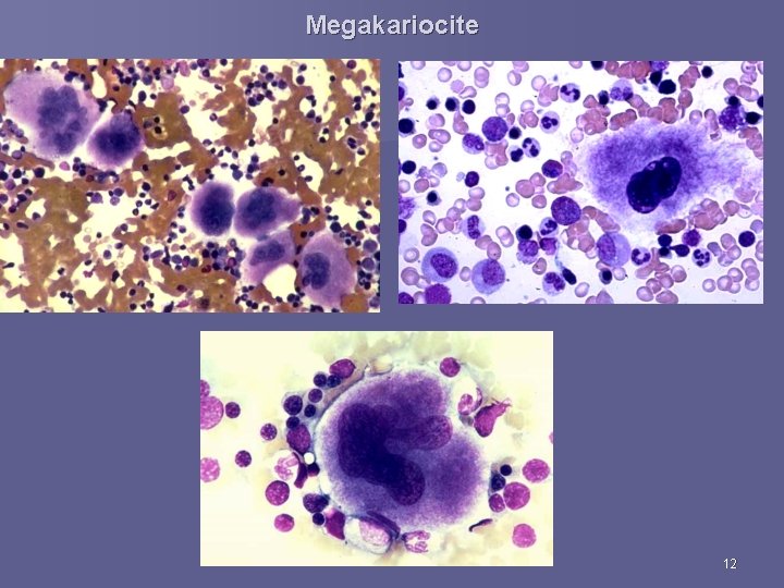 STHI ERITROCITOPOIEZA GRANULOCITOPOIEZA MEGAKARIOCITOPOIEZA ...