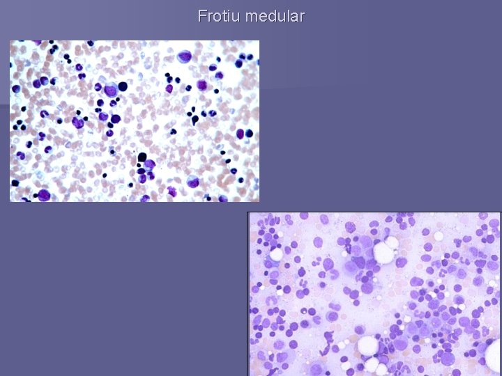 STHI ERITROCITOPOIEZA GRANULOCITOPOIEZA MEGAKARIOCITOPOIEZA ...