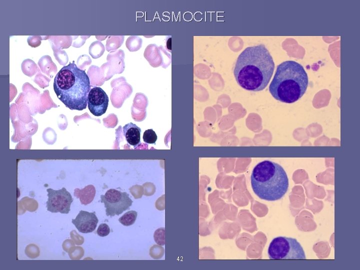 STHI ERITROCITOPOIEZA GRANULOCITOPOIEZA MEGAKARIOCITOPOIEZA ...