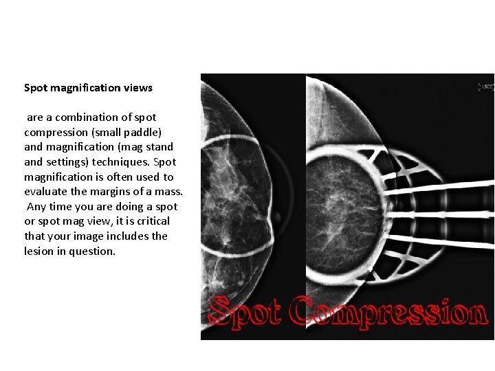 investigations of the breast lump Azra Tabassum Facts