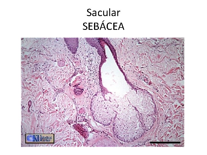 Histologa Laboratorio 3 Glndulas epitelios glandulares Glndulas exocrinas