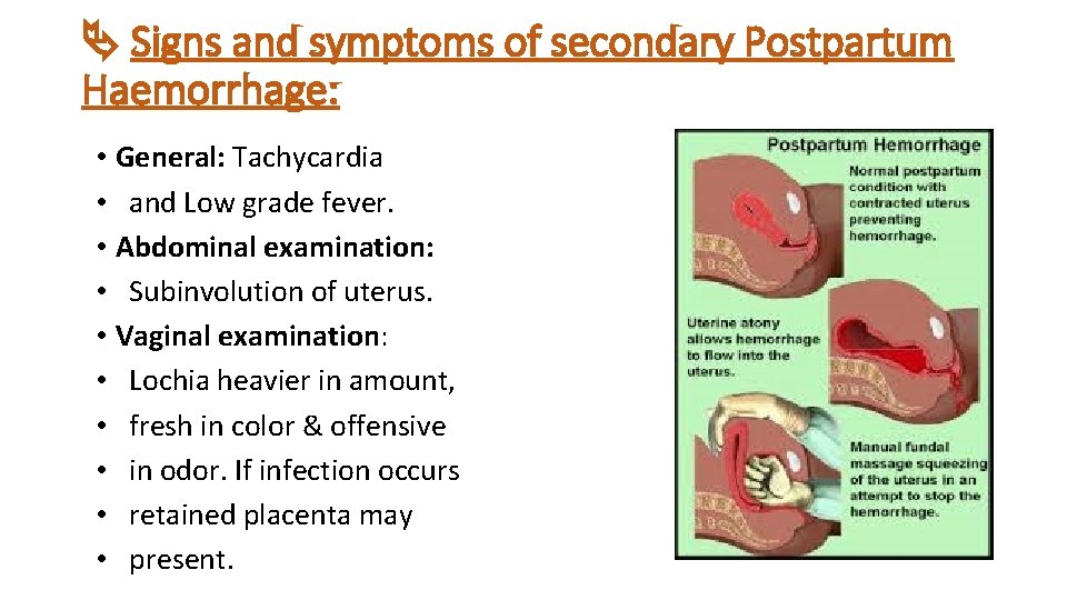 Pathophysiology Of Postpartum Hemorrhage