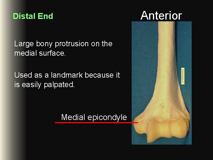 Anatomy of the Humerus and Shoulder 6 3