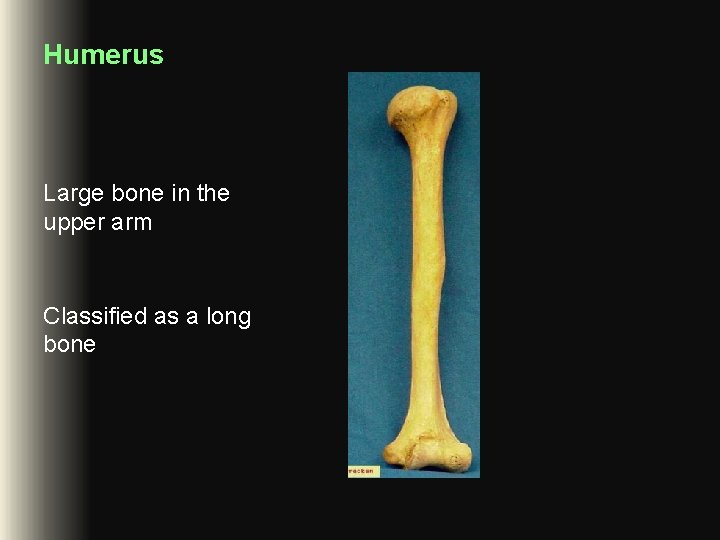 Anatomy of the Humerus and Shoulder 6 3