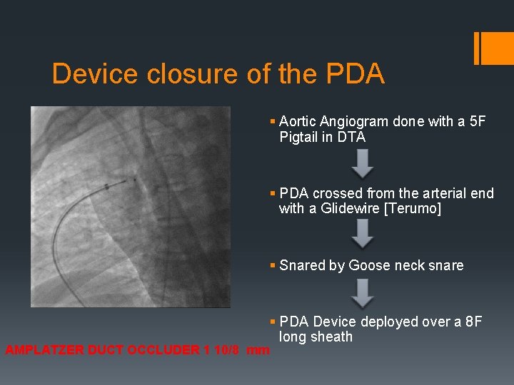 IVUS Guided PDA Closure Presenter Sharat K Operators