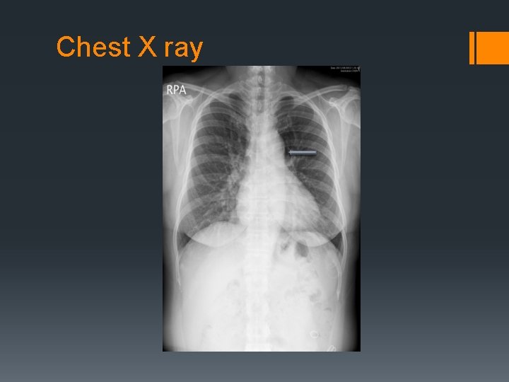 IVUS Guided PDA Closure Presenter Sharat K Operators