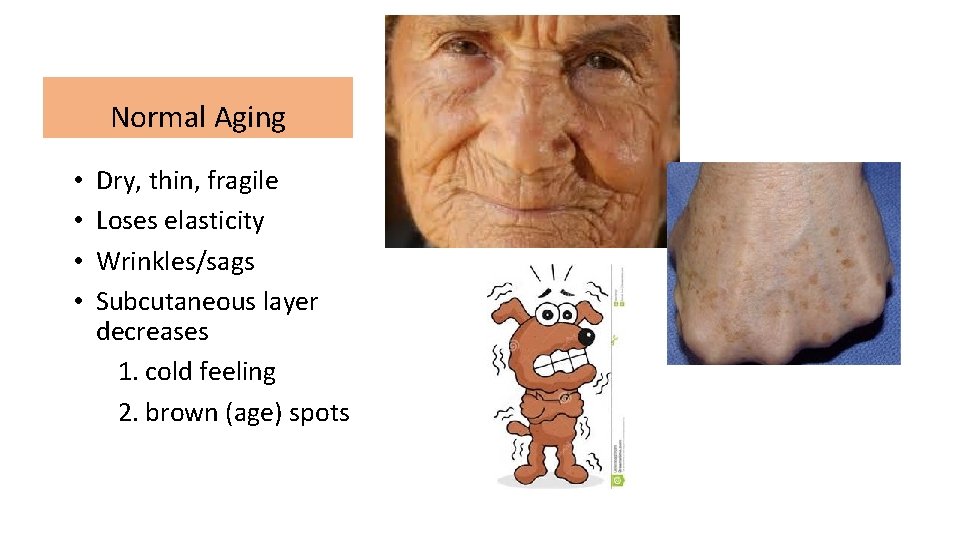 Lesson 15 Skin CarePressure Prevention Lesson Objectives The