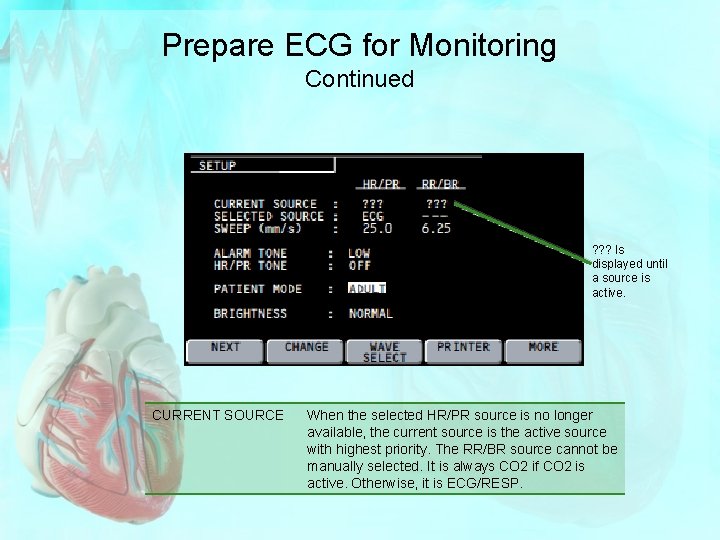 PATIENT MONITOR ECG Test By Keith Shivner Greg