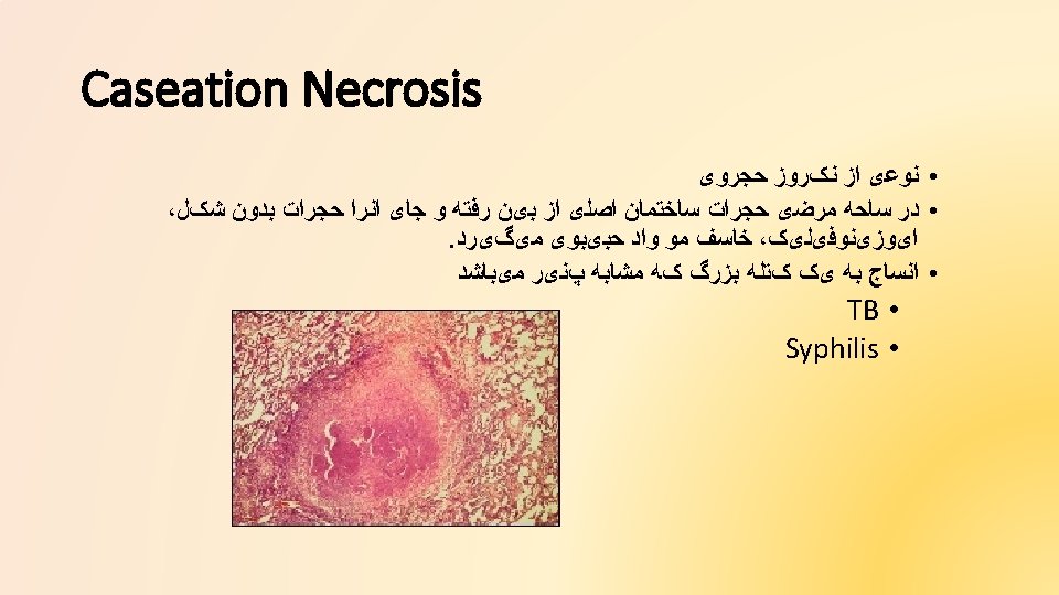 Histopathologic Dr Mohammad Arif Abid dermatologist Hyperkeratosis Wart