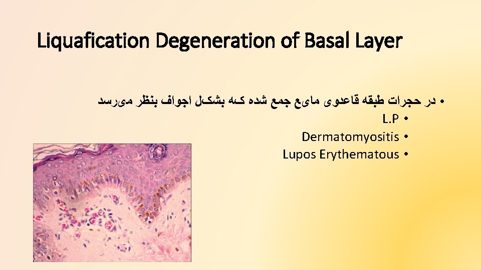Histopathologic Dr Mohammad Arif Abid dermatologist Hyperkeratosis Wart