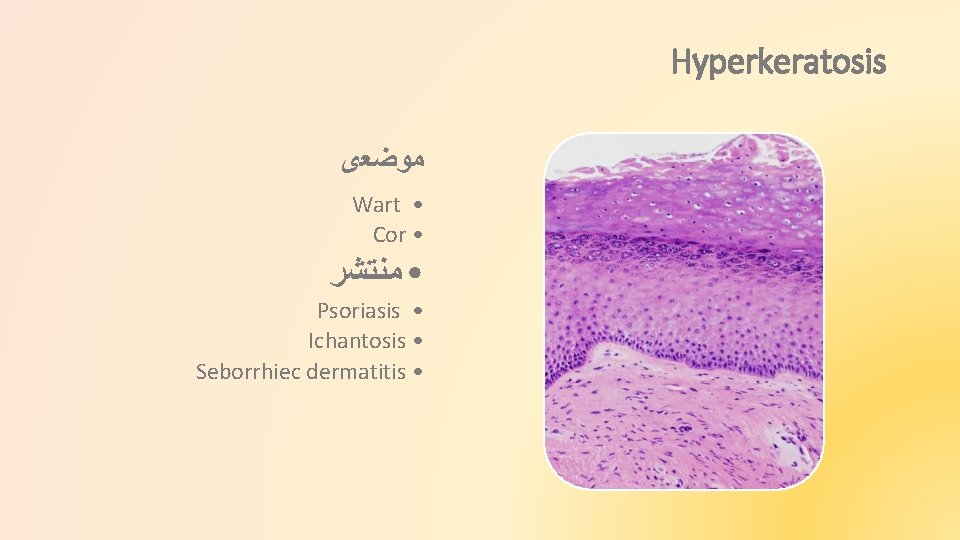 Histopathologic Dr Mohammad Arif Abid dermatologist Hyperkeratosis Wart