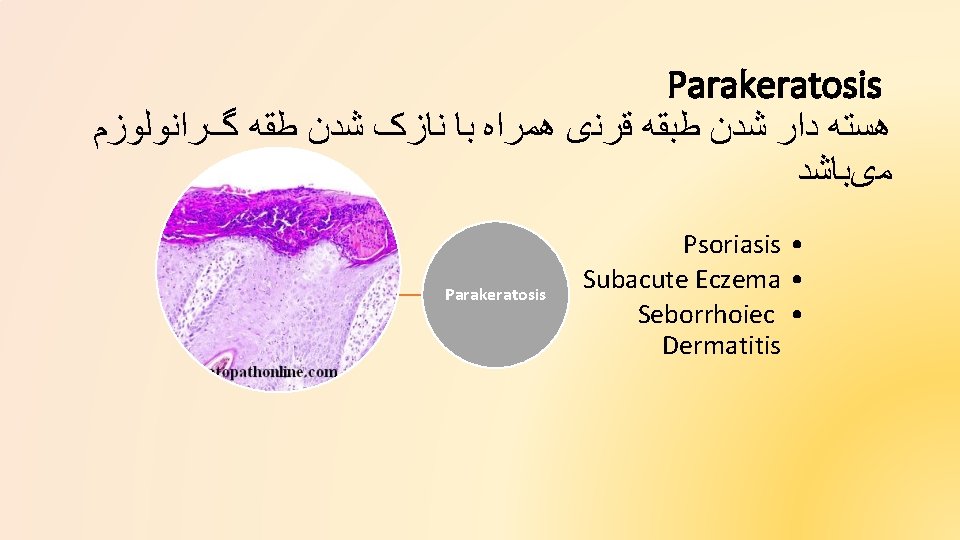 Histopathologic Dr Mohammad Arif Abid dermatologist Hyperkeratosis Wart