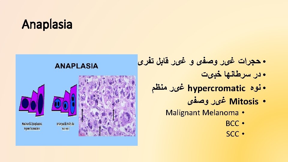 Histopathologic Dr Mohammad Arif Abid dermatologist Hyperkeratosis Wart