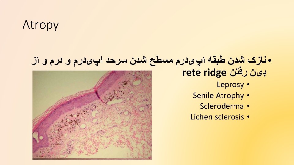 Histopathologic Dr Mohammad Arif Abid dermatologist Hyperkeratosis Wart